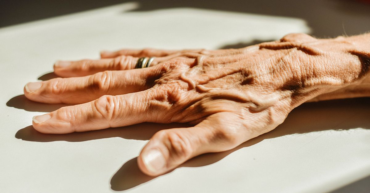 Real Veins And Arteries Abstract Medical Scientific Illustration Of