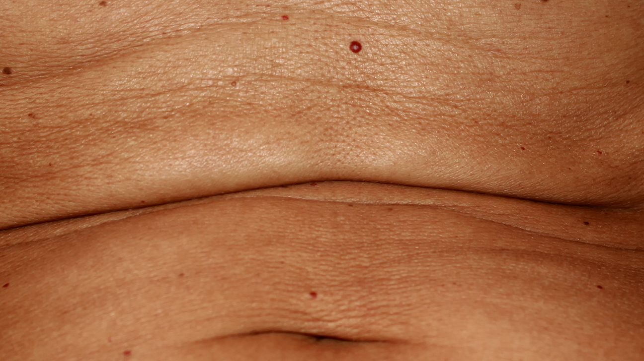Red moles store