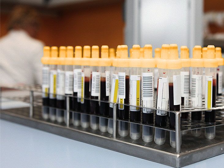 Blood Types in Genetics: ABO and Rh Type Inheritance