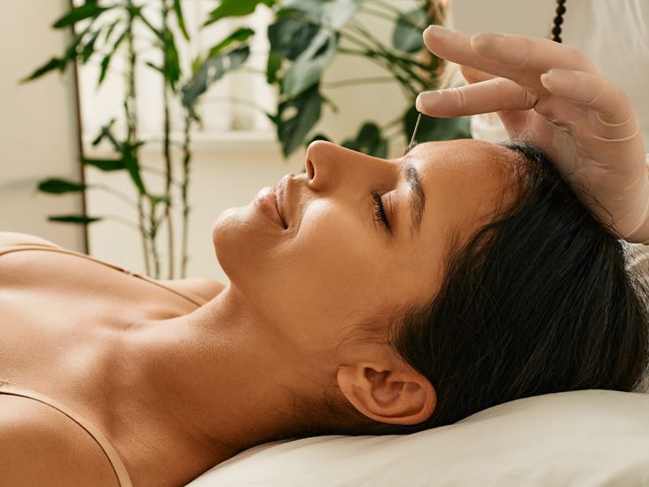 Acupuncture for Vertigo: What You Need to Know