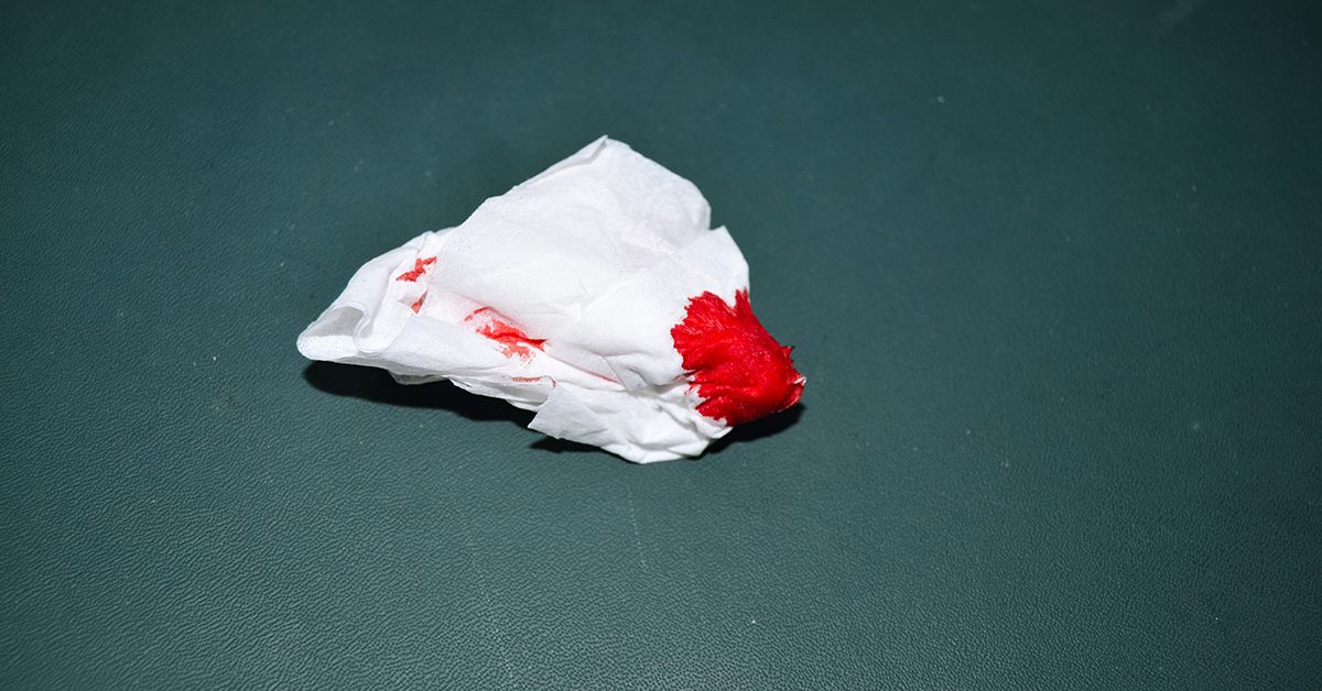 Nose Bleeding Is Called