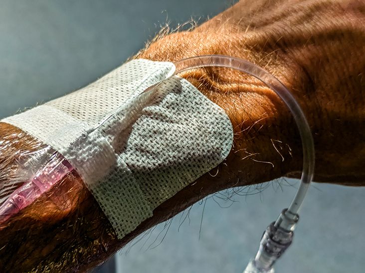 Reclast and Medicare: Is The Infusion Covered?