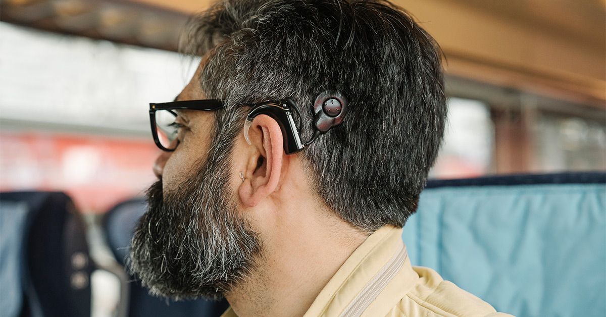 How Much Do Cochlear Implants Cost with Medicare?