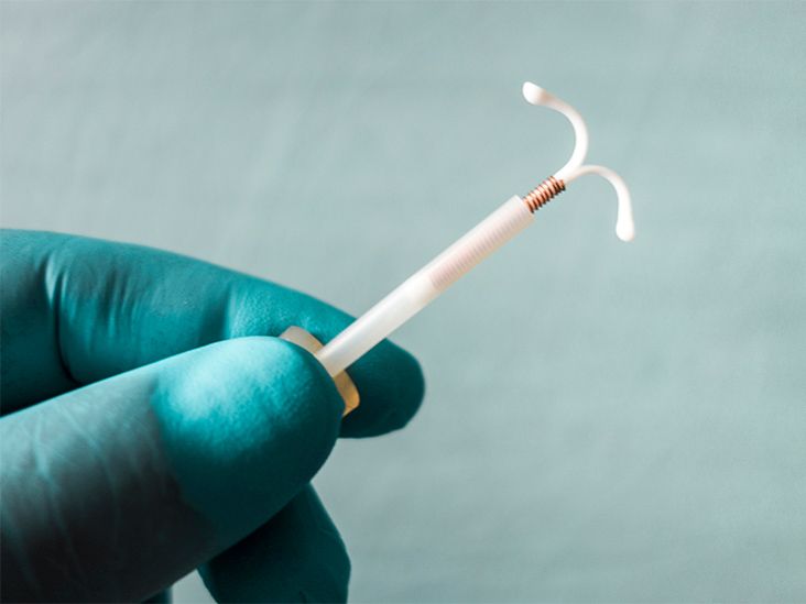 Is IUD Insertion Painful? Expert Answers You Need to Know