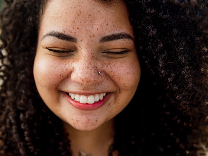 What Can Cause Freckles to Appear Suddenly?