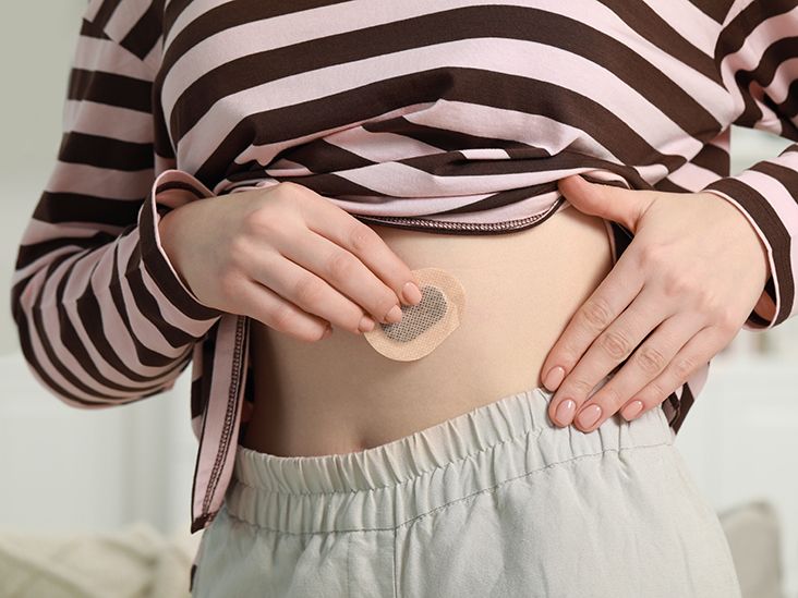 Birth Control Patch Side Effects, Risks, and Things to Consider