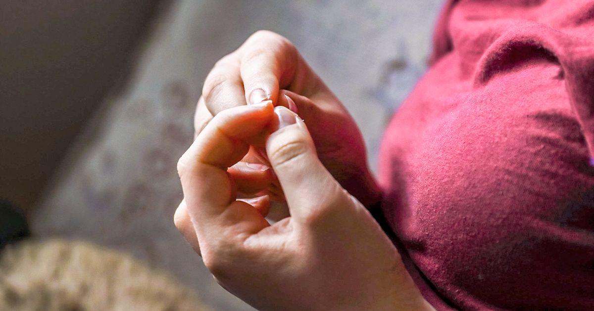 Disappearing Nail Bed: Symptoms, Causes, Diagnosis, Treatment
