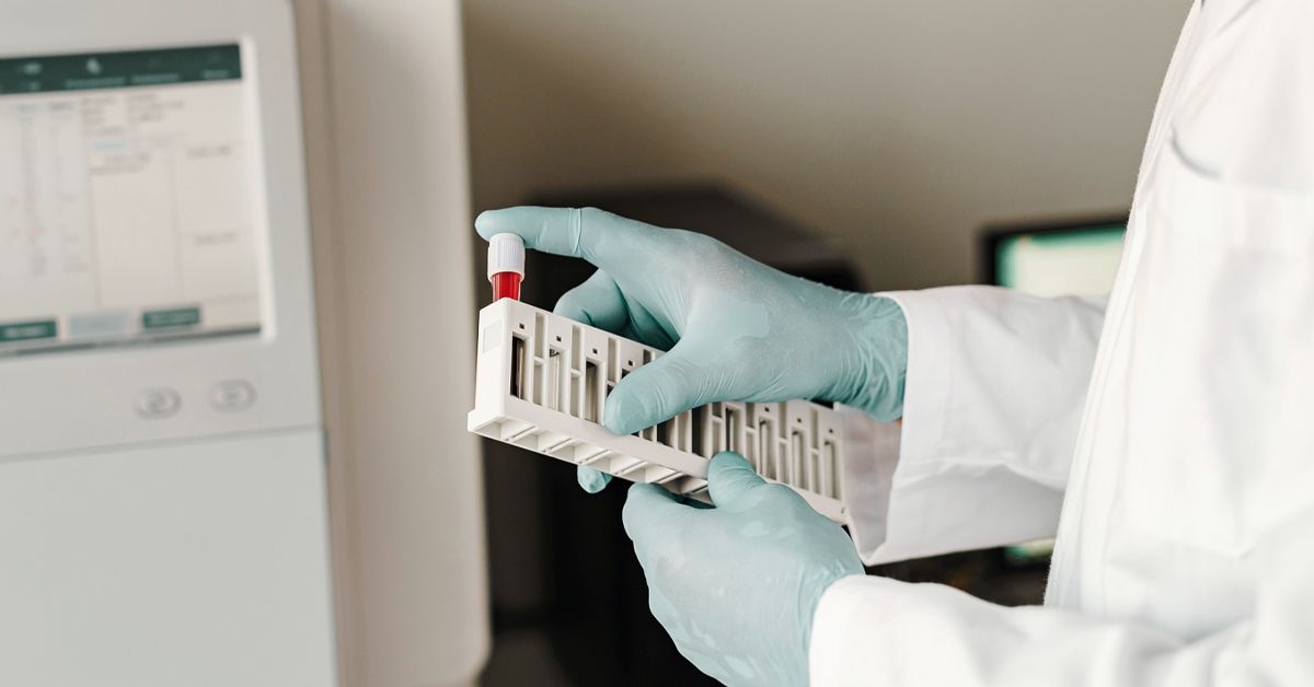 Can Narcolepsy Be Diagnosed with a Blood Test?