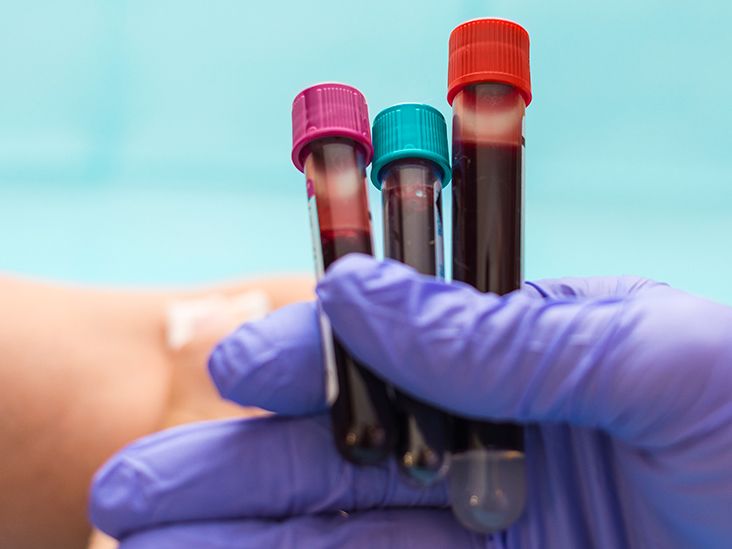 Factor VIII Assay: Purpose, Preparation, Results, and More