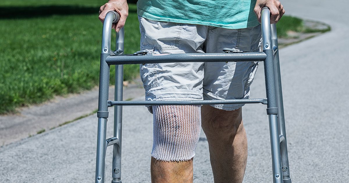 Knee Replacement Recovery Time: What to Expect in the First 12 Weeks