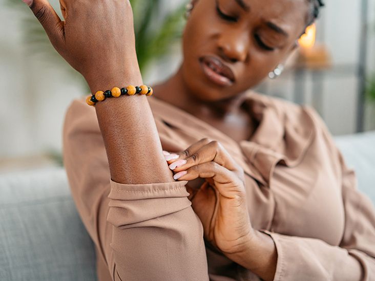 Hives vs. Bug Bite: How to Tell the Difference