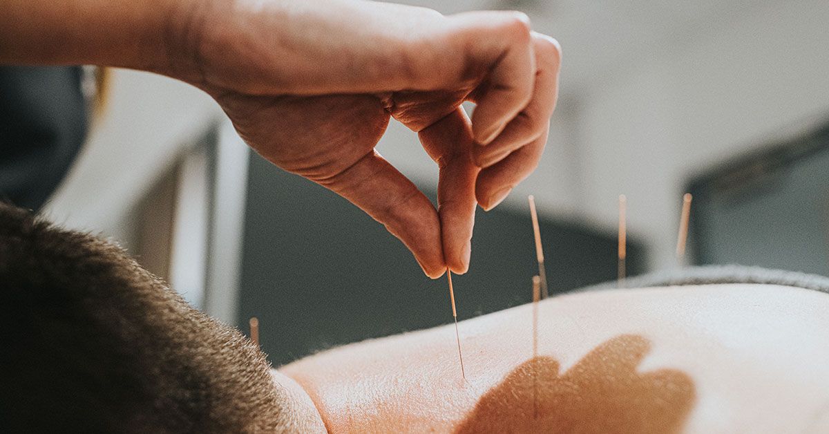Acupuncture for Diabetes: Safety and Benefits