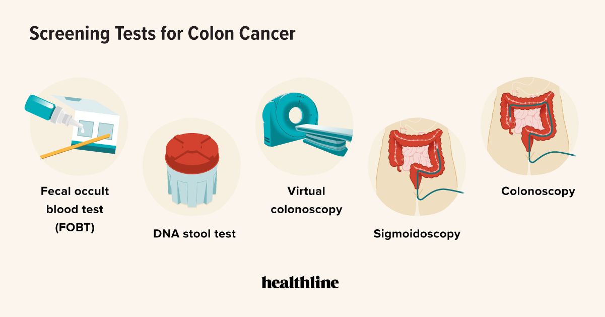 Comparison of Colon Cancer Screening Tests