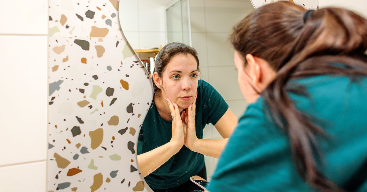 Hyperthyroidism Face: Symptoms, Causes, Treatment, More