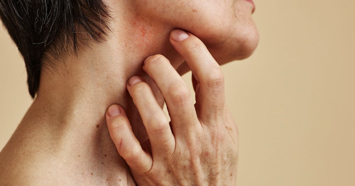 Dry vs. Dehydrated Skin: Treatments and How To Tell the Difference