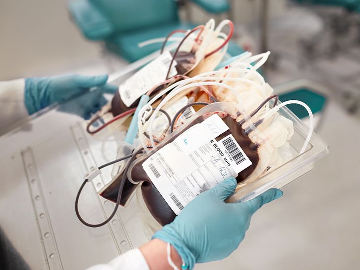How Much Is 500 Cc Of Blood Loss