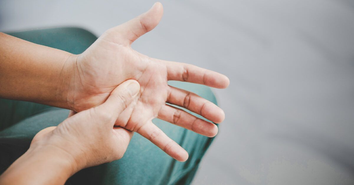 What Dupuytren's Contracture Looks Like