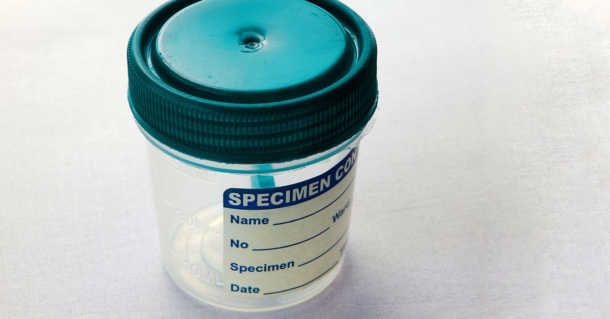 Testing for parasites on Medicare