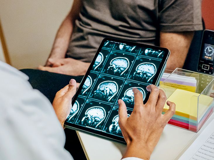 Ventricles of the Brain: Structure, Function, and Common Disorders
