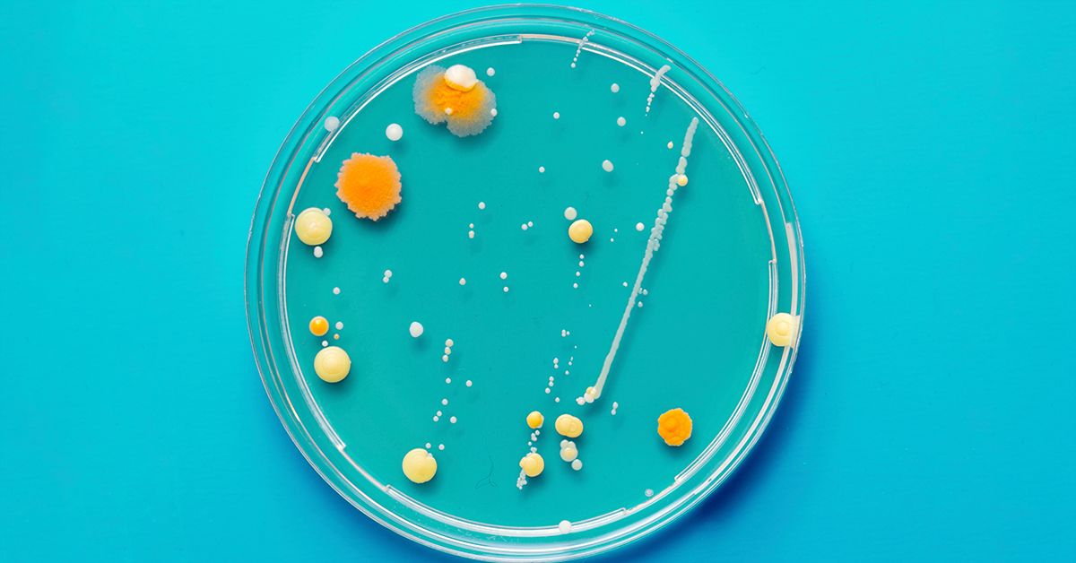 Chlamydia Species: Transmission, Complications, Prevention