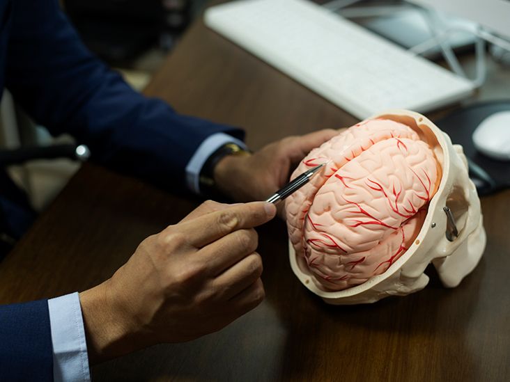 Deep Brain Stimulation: Procedure, Benefits, Complications, and More