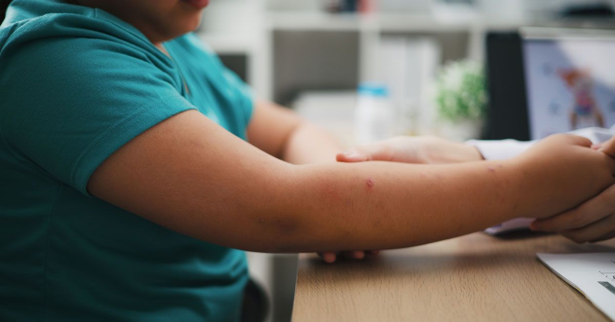 Skin Picking and ADHD: Is There a Link?