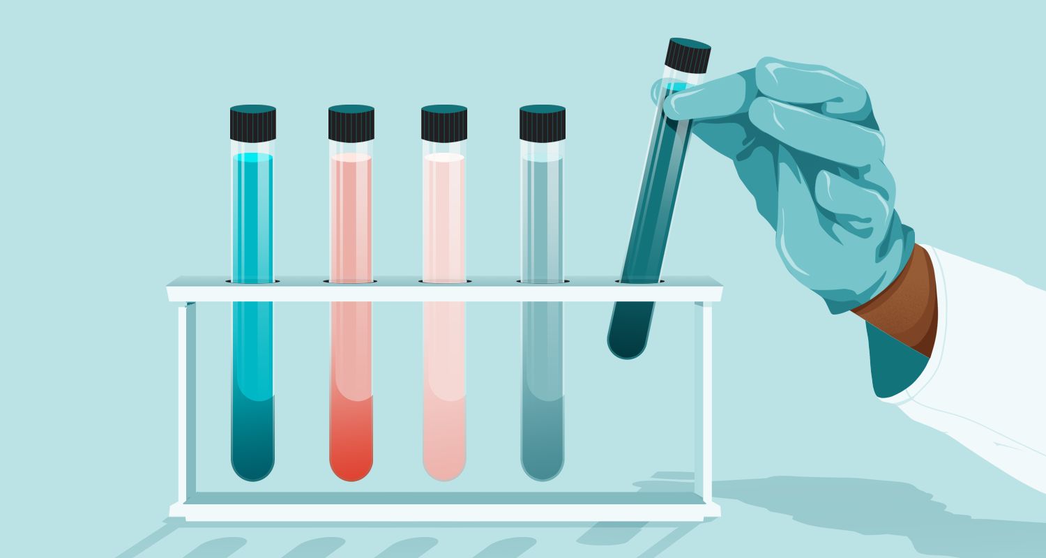 test tube rack with five samples