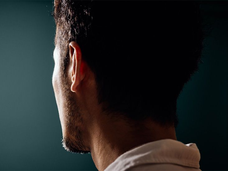 Acromegaly Facial Changes