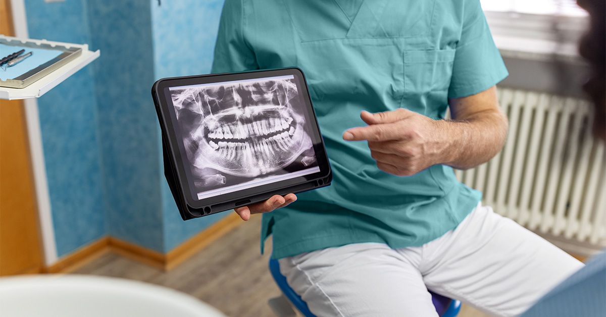 X-Ray: Purpose, Procedure, and Possible Risks