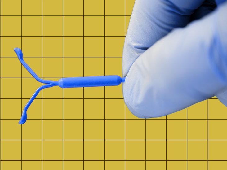Mirena Iud Side Effects
