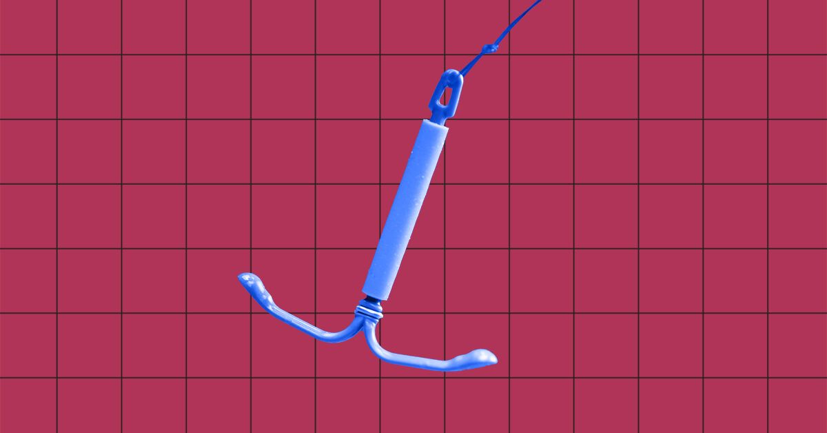 Is a Birth Control IUD Right for You?