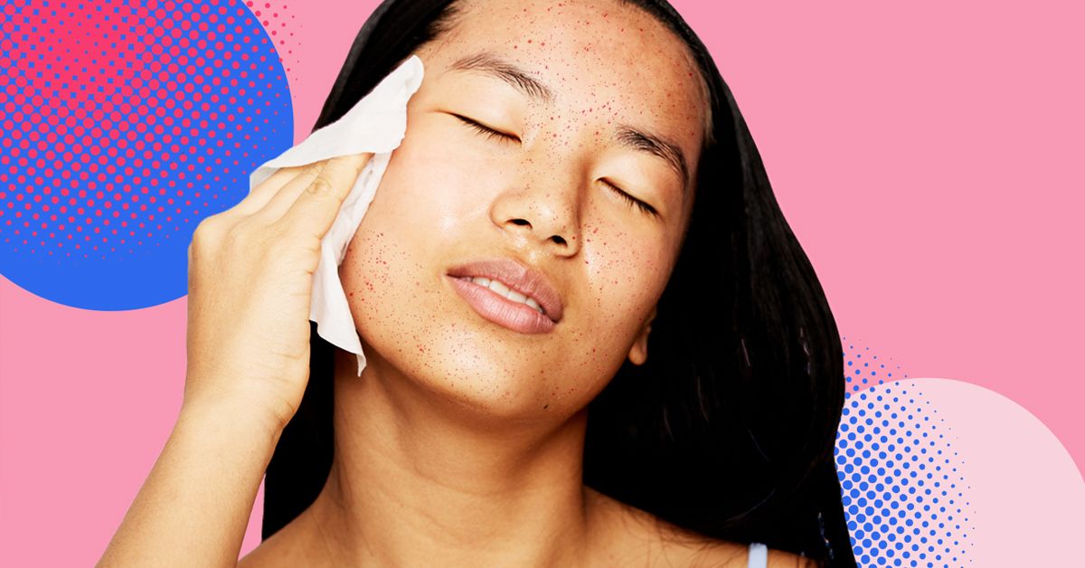 Understanding Acne Scars Types and Treatment Options