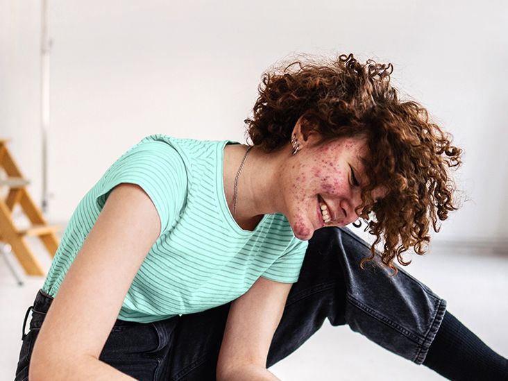 Hidradenitis Suppurativa vs. Other Skin Conditions