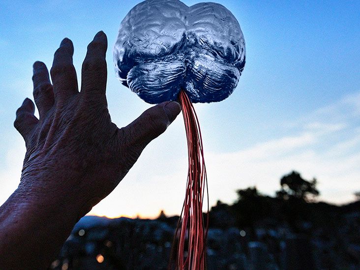 Todd's paralysis: Symptoms, causes, and what to do