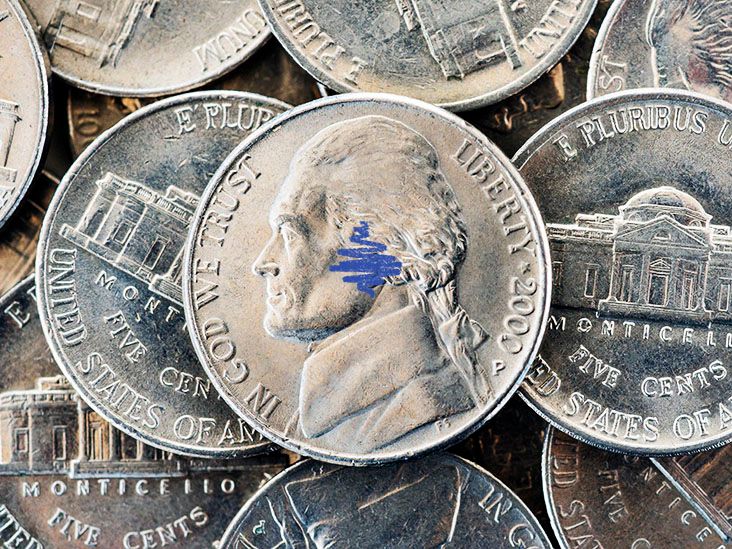 Nickel allergy: Symptoms, treatment, and what to avoid