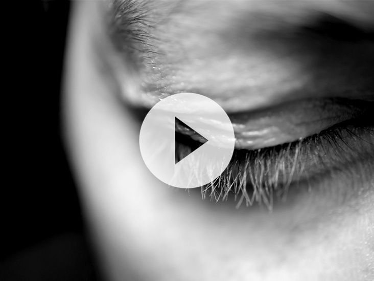 Punctal plugs for dry eye