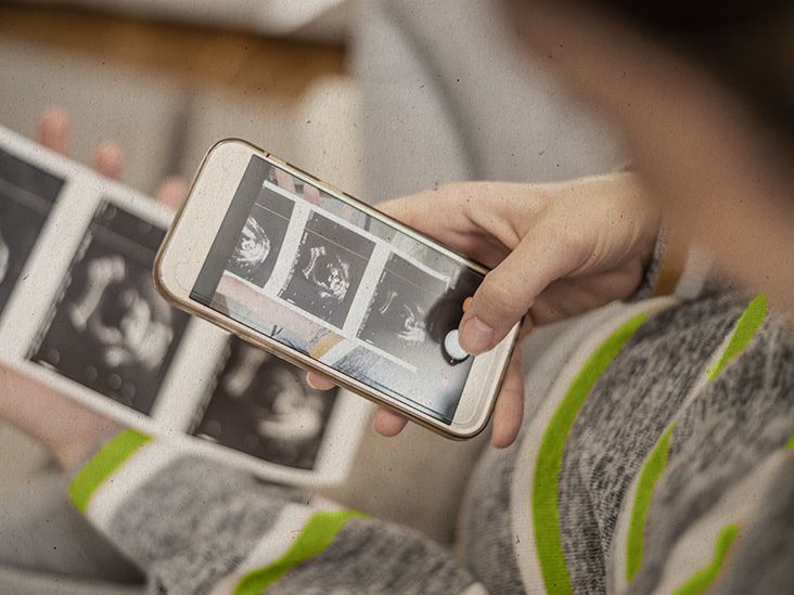 Baby position in womb: What they are and how to tell