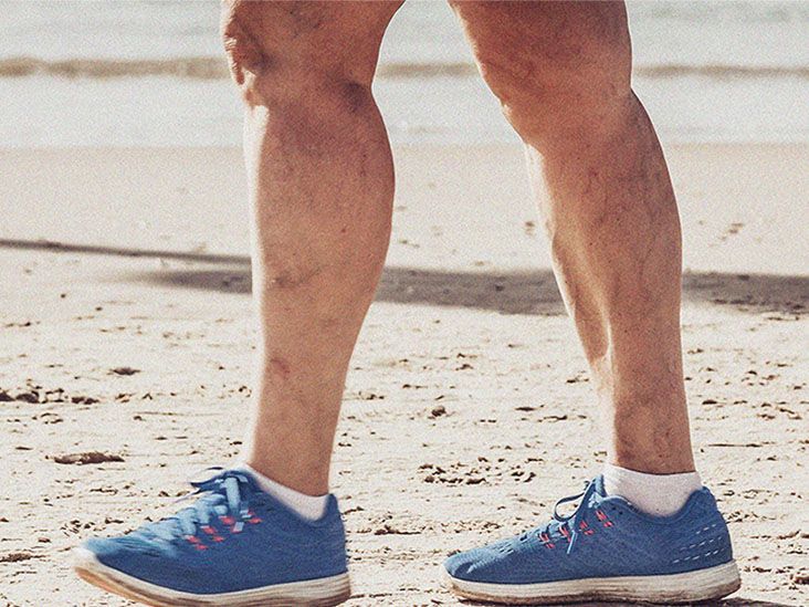 Symmetric vs. asymmetric arthritis: Differences and diagnosis
