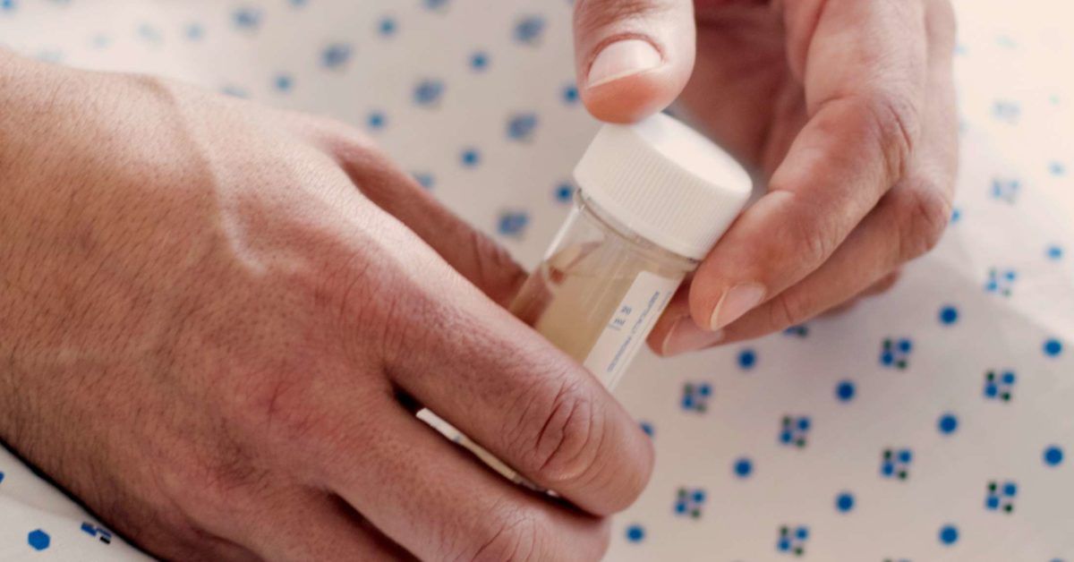 Creatinine urine test: Uses, procedure, and results
