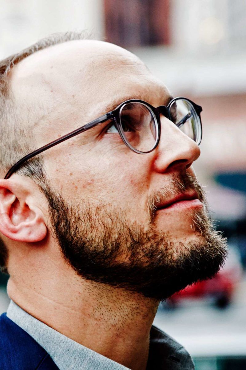 Hair loss on temples: Causes and what to do