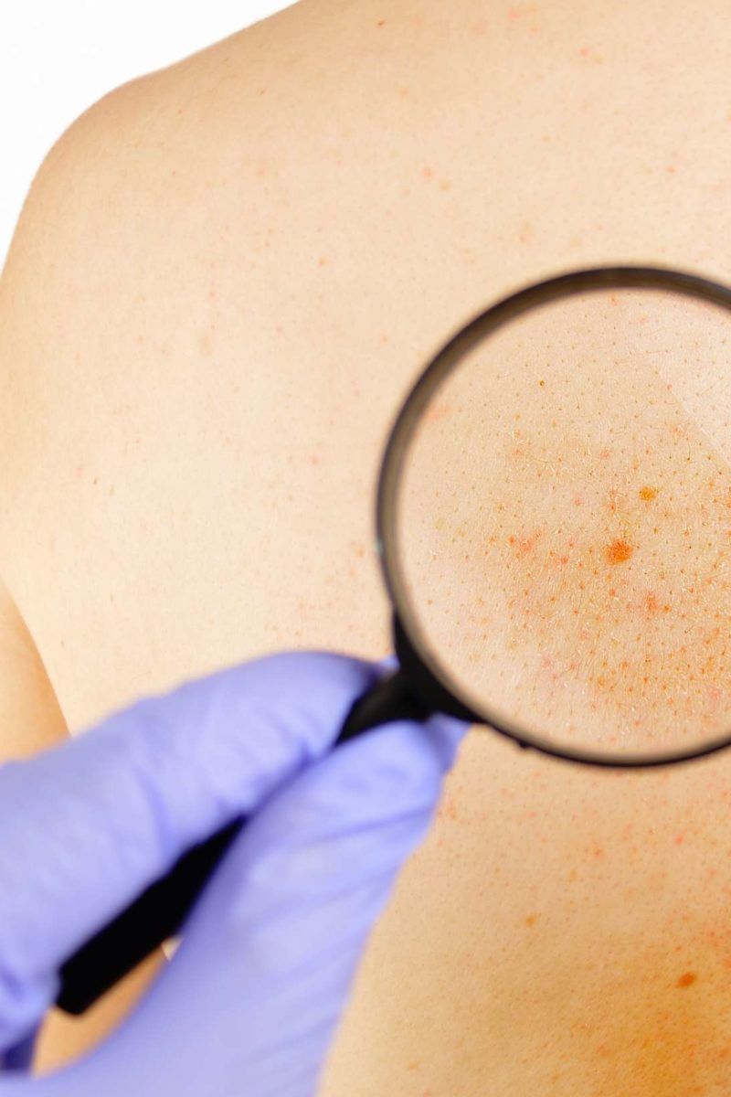 Signs and symptoms: Definition, importance, and uses