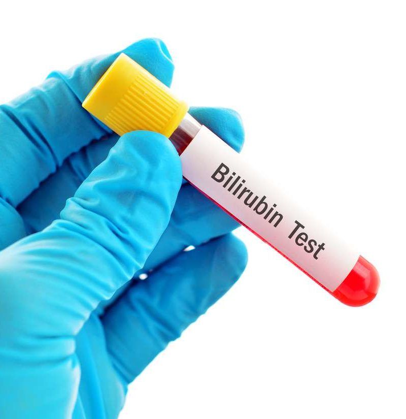 Gilbert syndrome: Symptoms, diet, and treatment