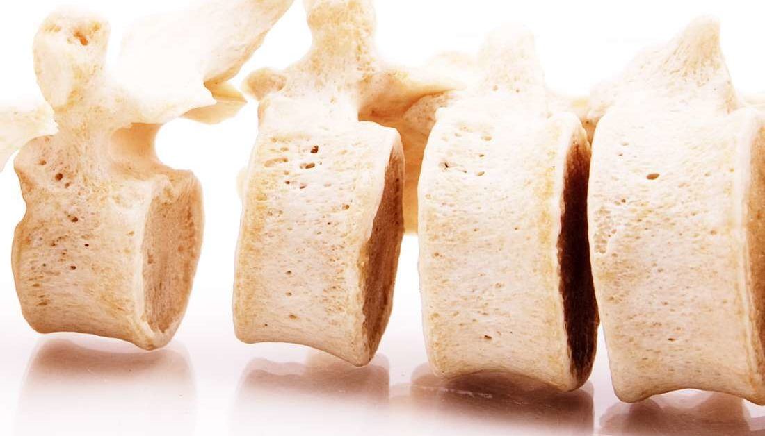 Spina bifida: Symptoms, causes, diagnosis, and treatment