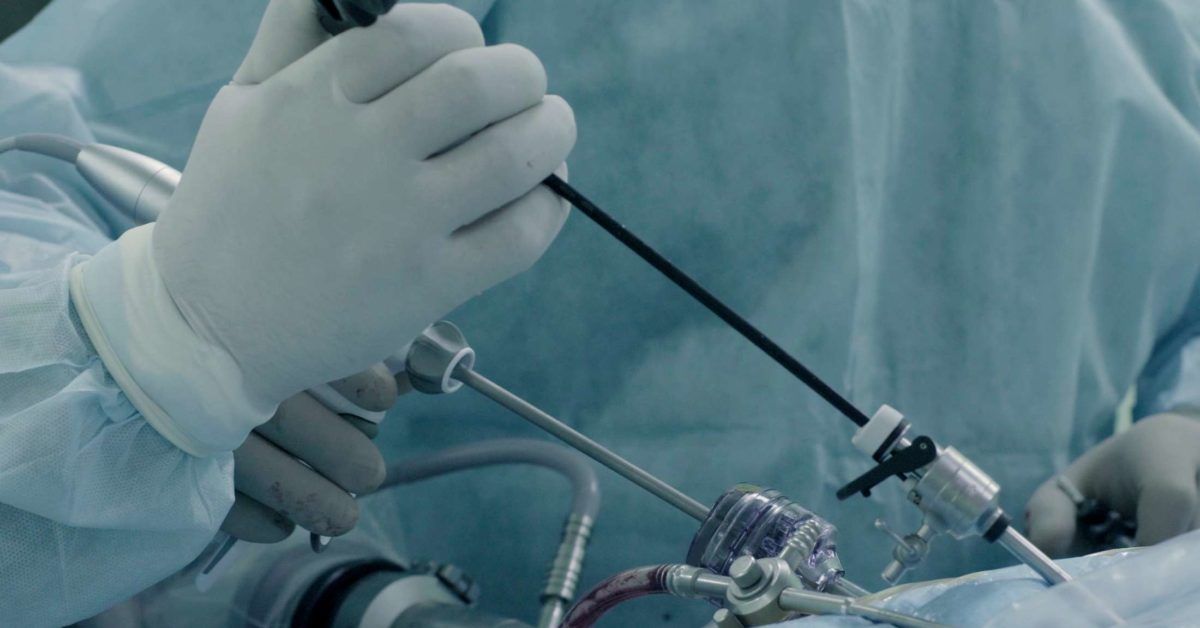 Laparoscopy (pelvic): Uses, risks, and benefits