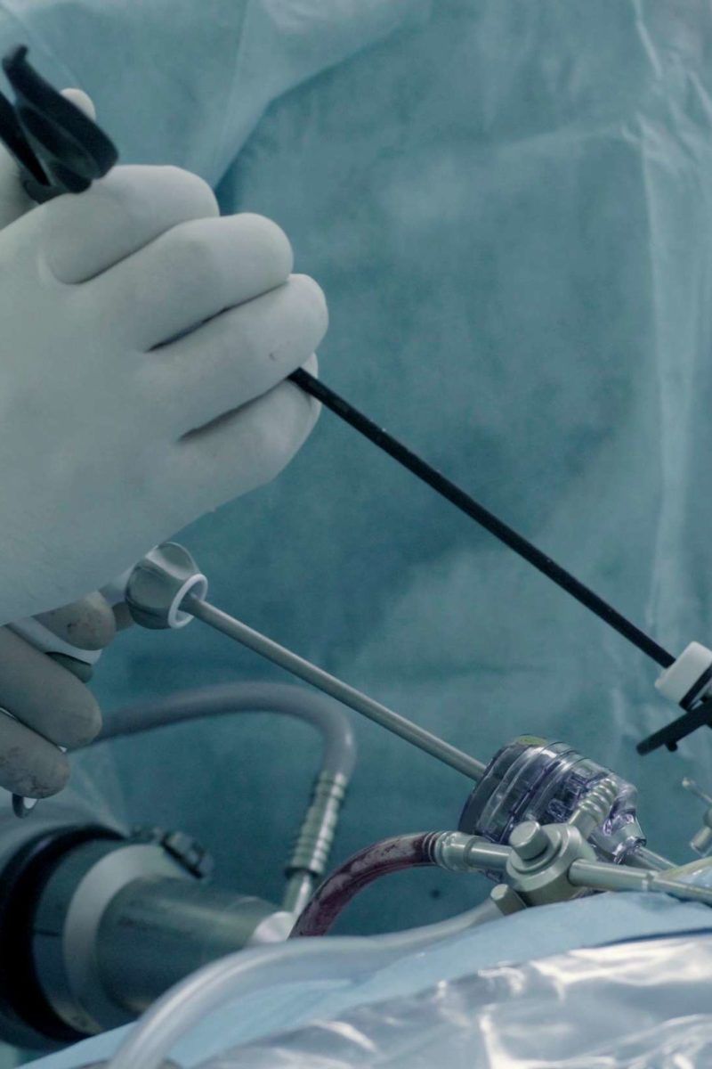 Laparoscopy (pelvic): Uses, risks, and benefits