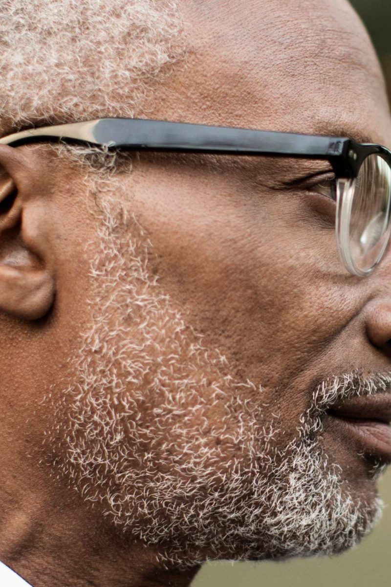 Homocystinuria: Causes, symptoms, and tests