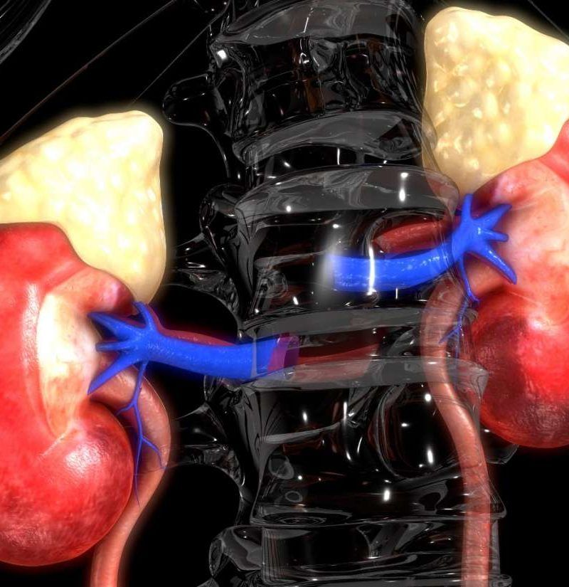 Hyperphosphatemia: Causes, symptoms, and treatment