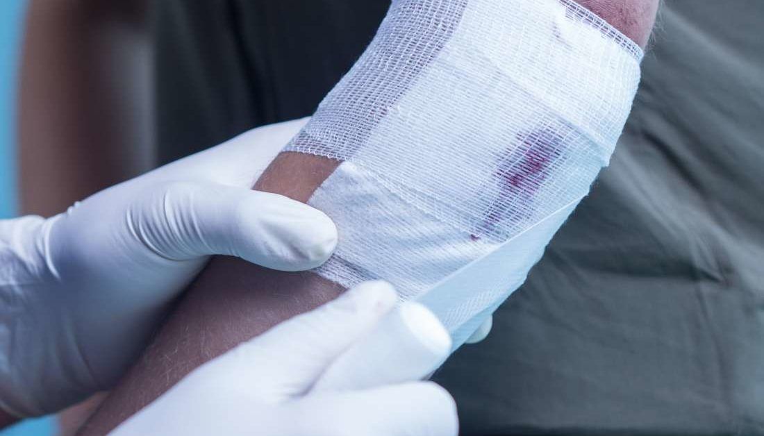 Serosanguineous drainage: Definition, causes, and types