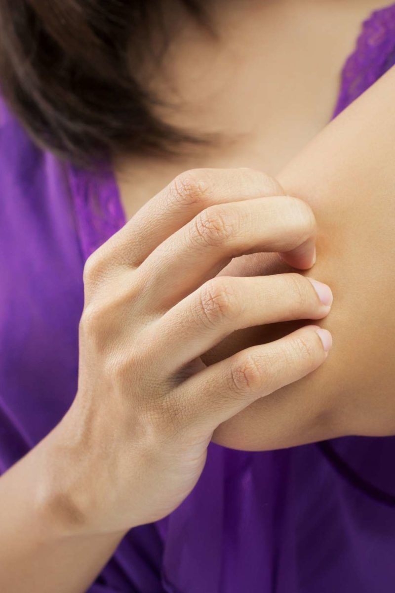 Spongiotic dermatitis: Symptoms, causes, and treatment