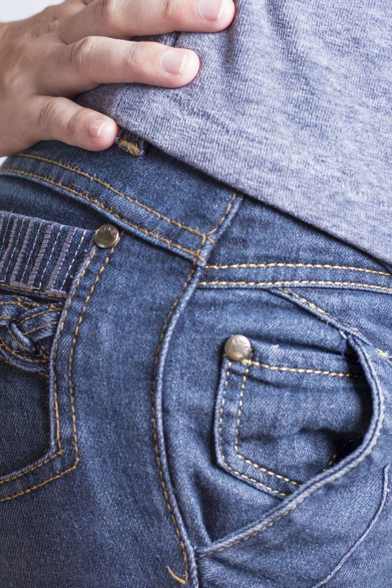 Pain in the buttocks: Is my sciatica causing it?